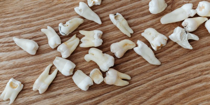 Tooth Extraction Healing Process: Stages, Care & Timeline